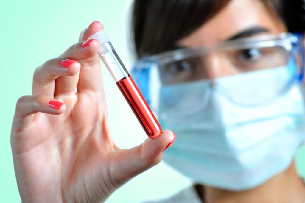 Revoluție în lumea medicală: Testul de sânge care poate depista 50 de ...